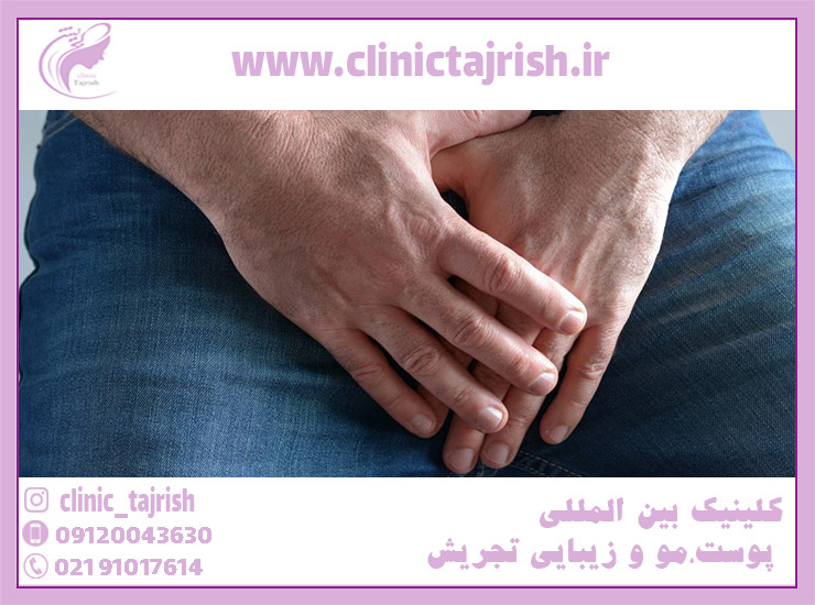 روش های بزرگ کردن آلت تناسلی کلینیک پوست و مو زیبایی تجریش